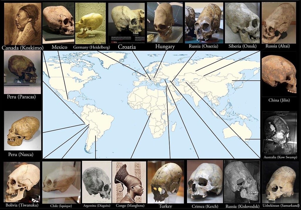 Elongated #skulls from all around the world - Giza Community